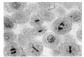 Solved Edexcel A level biology Stages of mitosis may be | Chegg.com