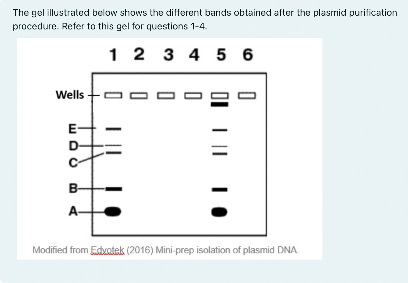 Solved The gel illustrated below shows the different bands | Chegg.com