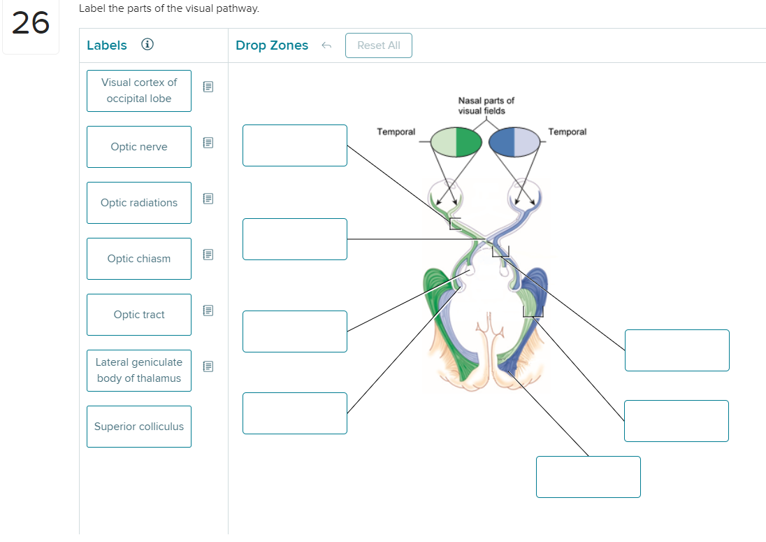 Solved Label the parts of the visual pathway. | Chegg.com