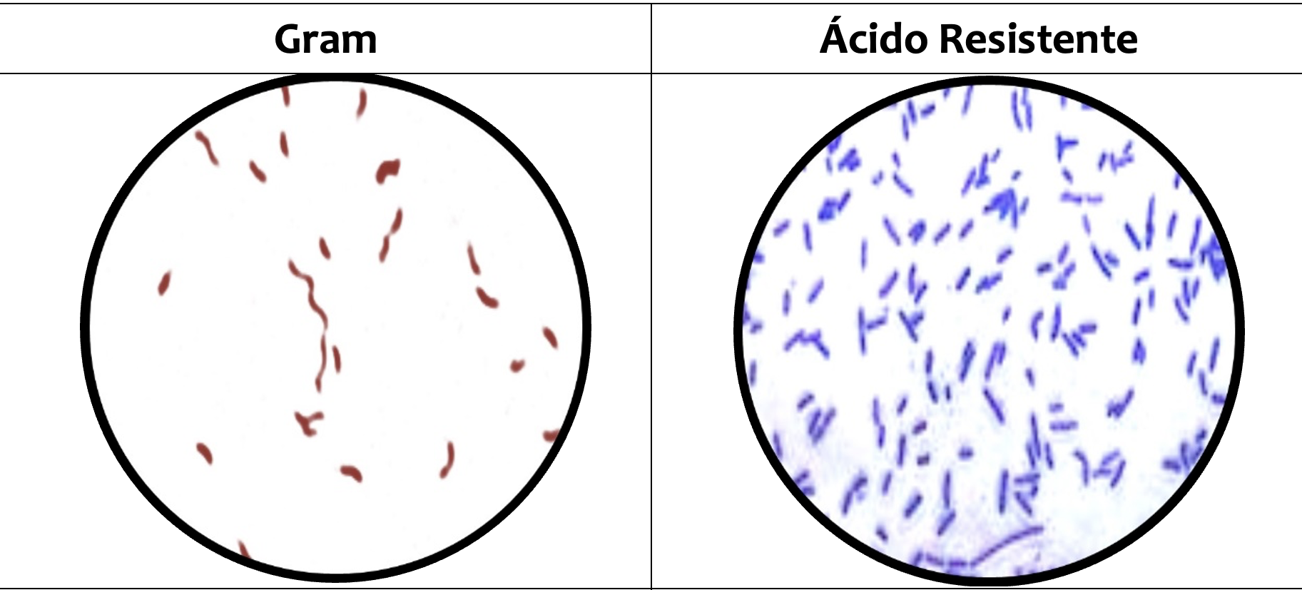 Haemophilus Influenzae Gram Stain