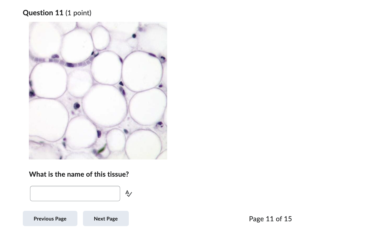 Solved Question 11 (1 point) What is the name of this | Chegg.com