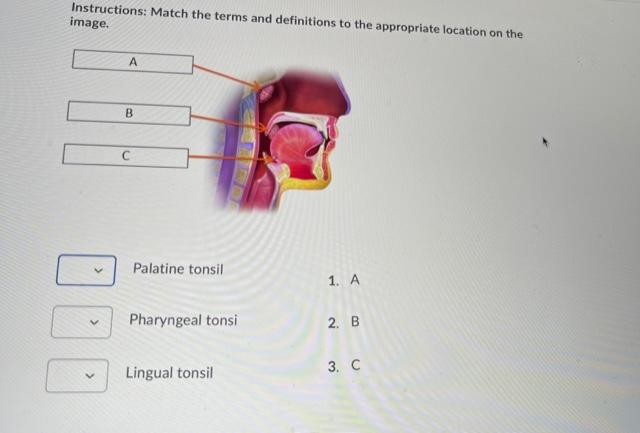 Solved Instructions: Match the terms and definitions to the | Chegg.com