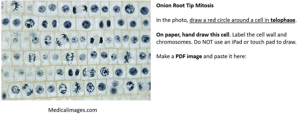 Solved Onion Root Tip Mitosis In The Photo Draw A Red Chegg