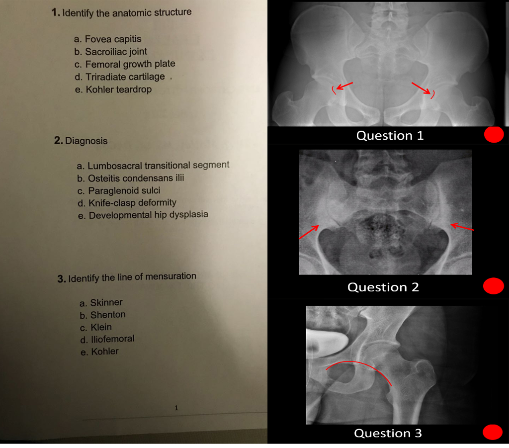 Solved 1. Identify the anatomic structure a. Fovea capitis | Chegg.com