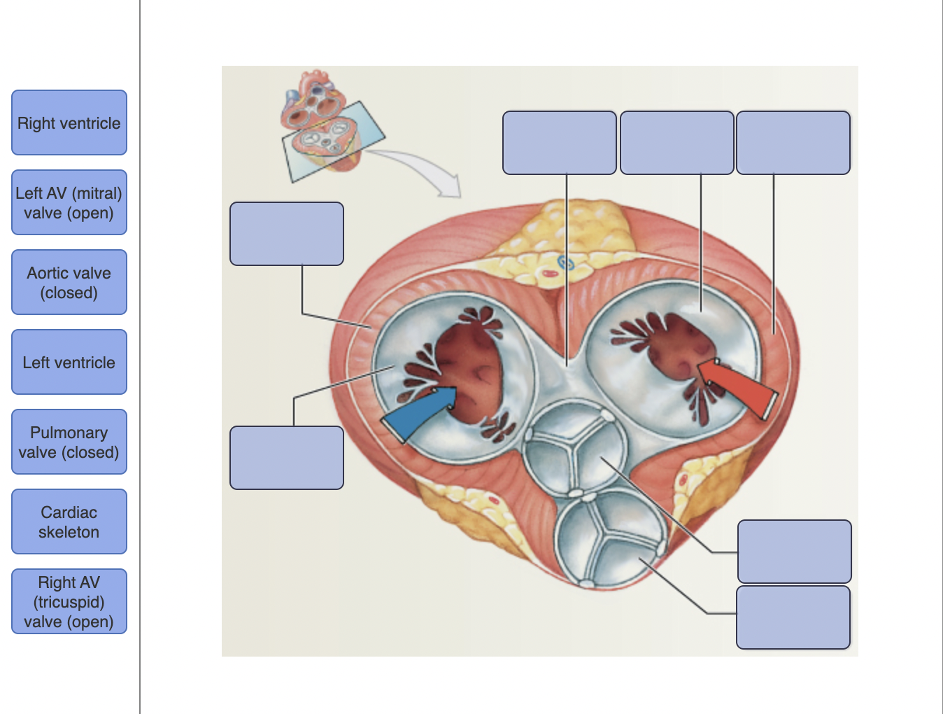 Solved Right ventricle 1 Left AV (mitral) valve (open) | Chegg.com