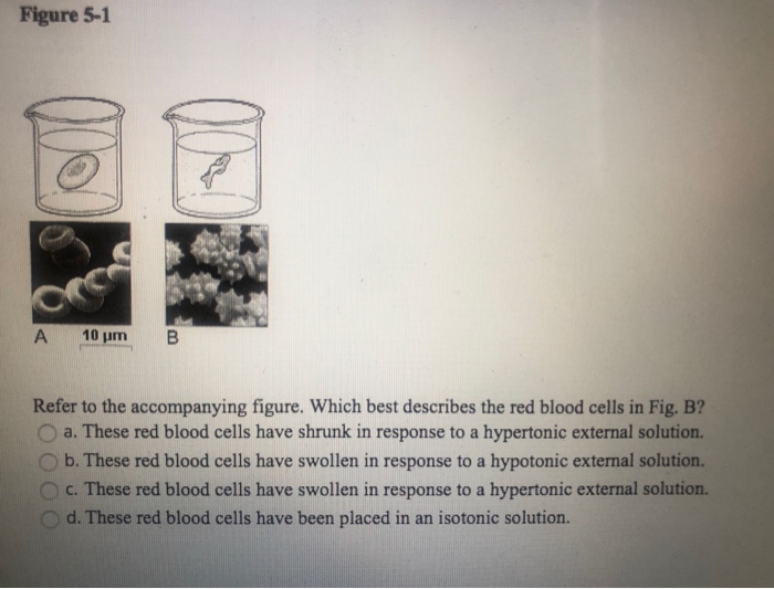 Solved Figure 5-1 A 10 um B Refer to the accompanying | Chegg.com