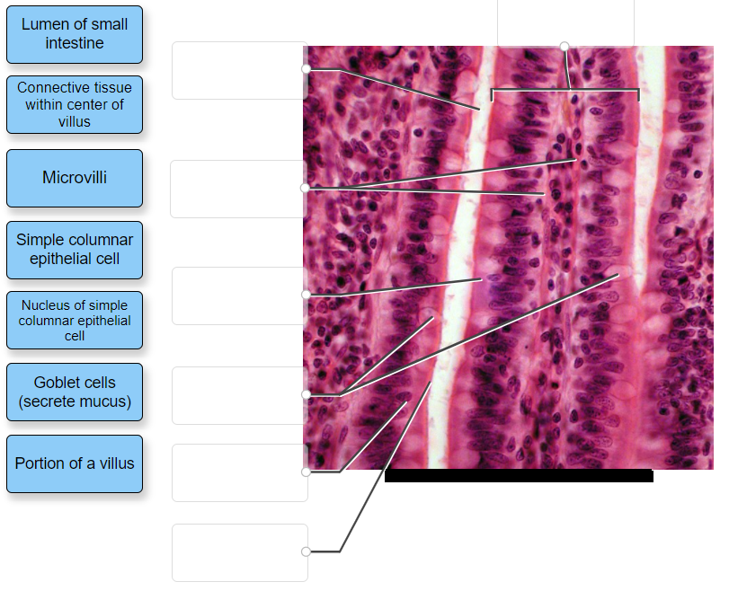 Solved Label the histological section of the small intestine | Chegg.com