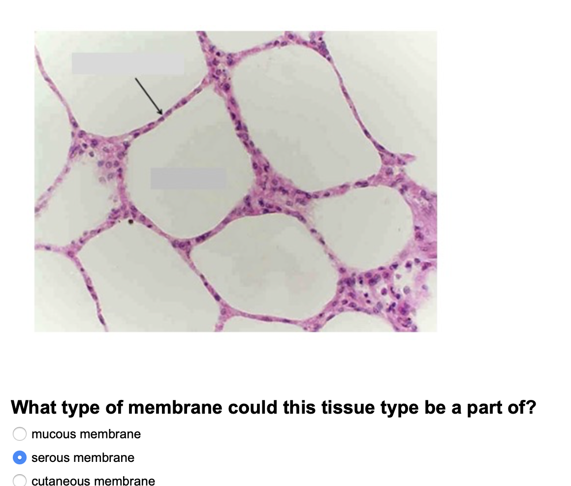 Solved What type of membrane could this tissue type be a | Chegg.com