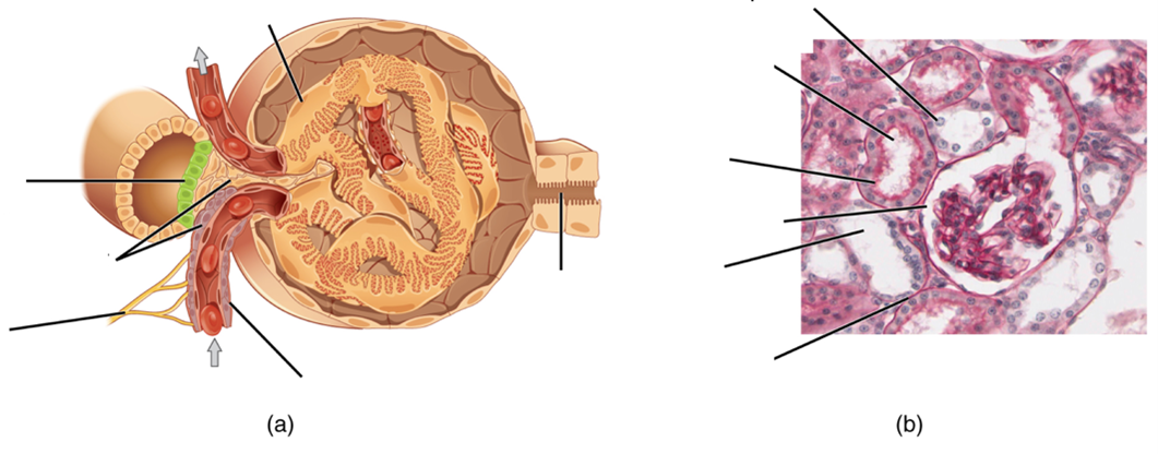 Solved Please label the following on this image of a | Chegg.com