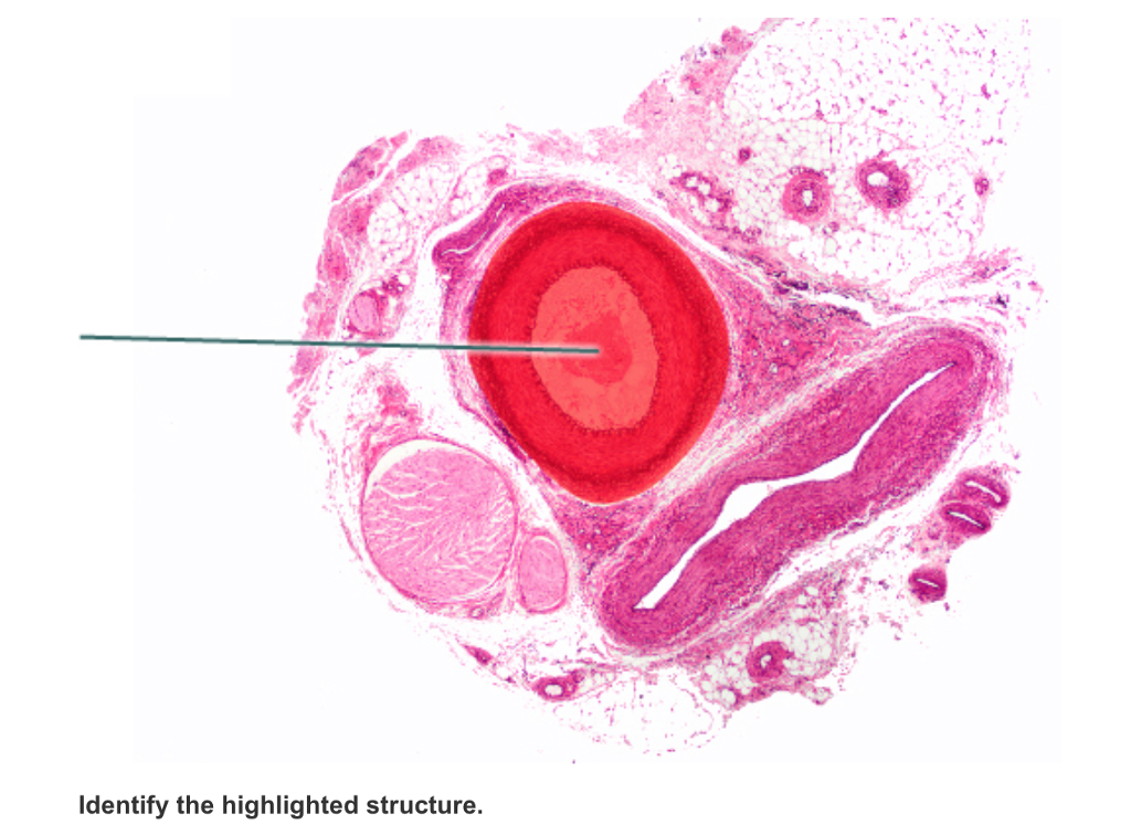 Solved Identify the highlighted structure. | Chegg.com