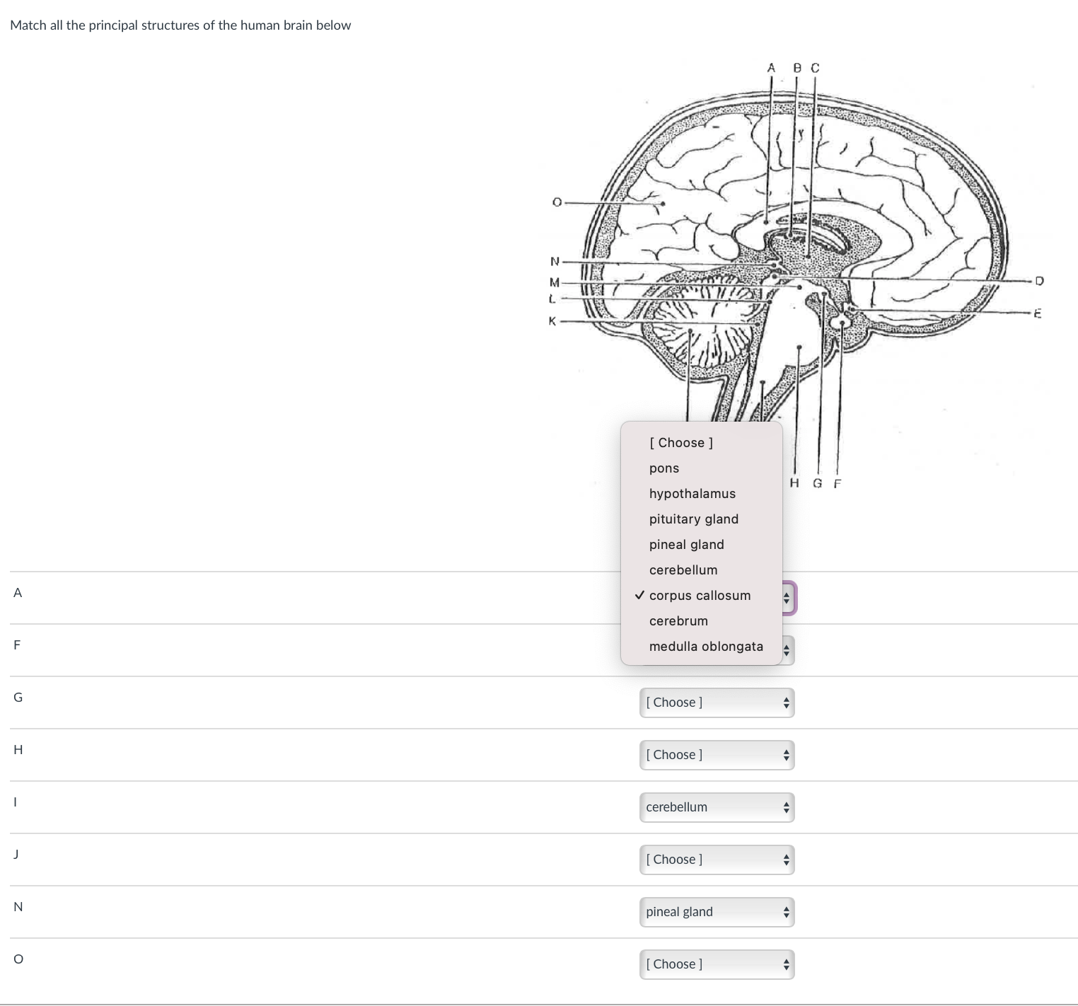 Solved Match all the principal structures of the human brain | Chegg.com