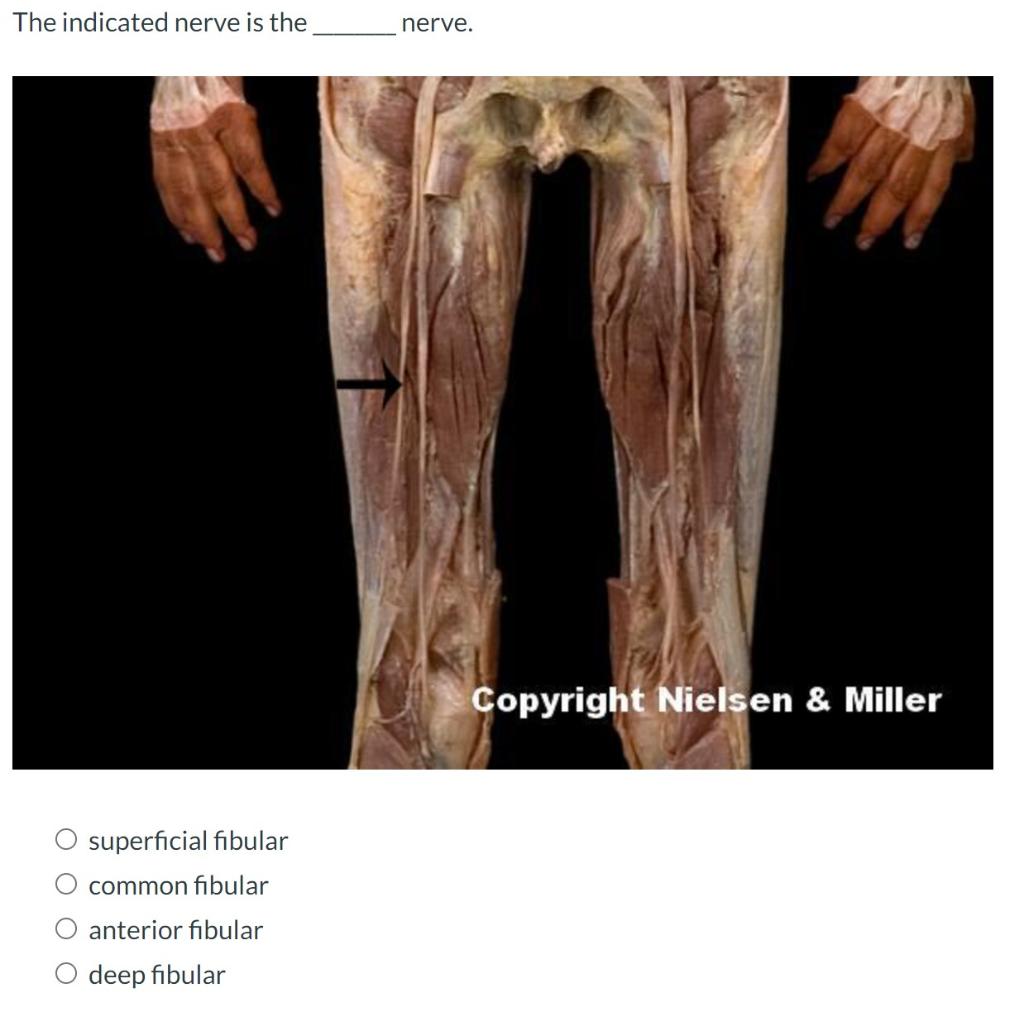 [Solved]: The indicated nerve is the superficial fibular c