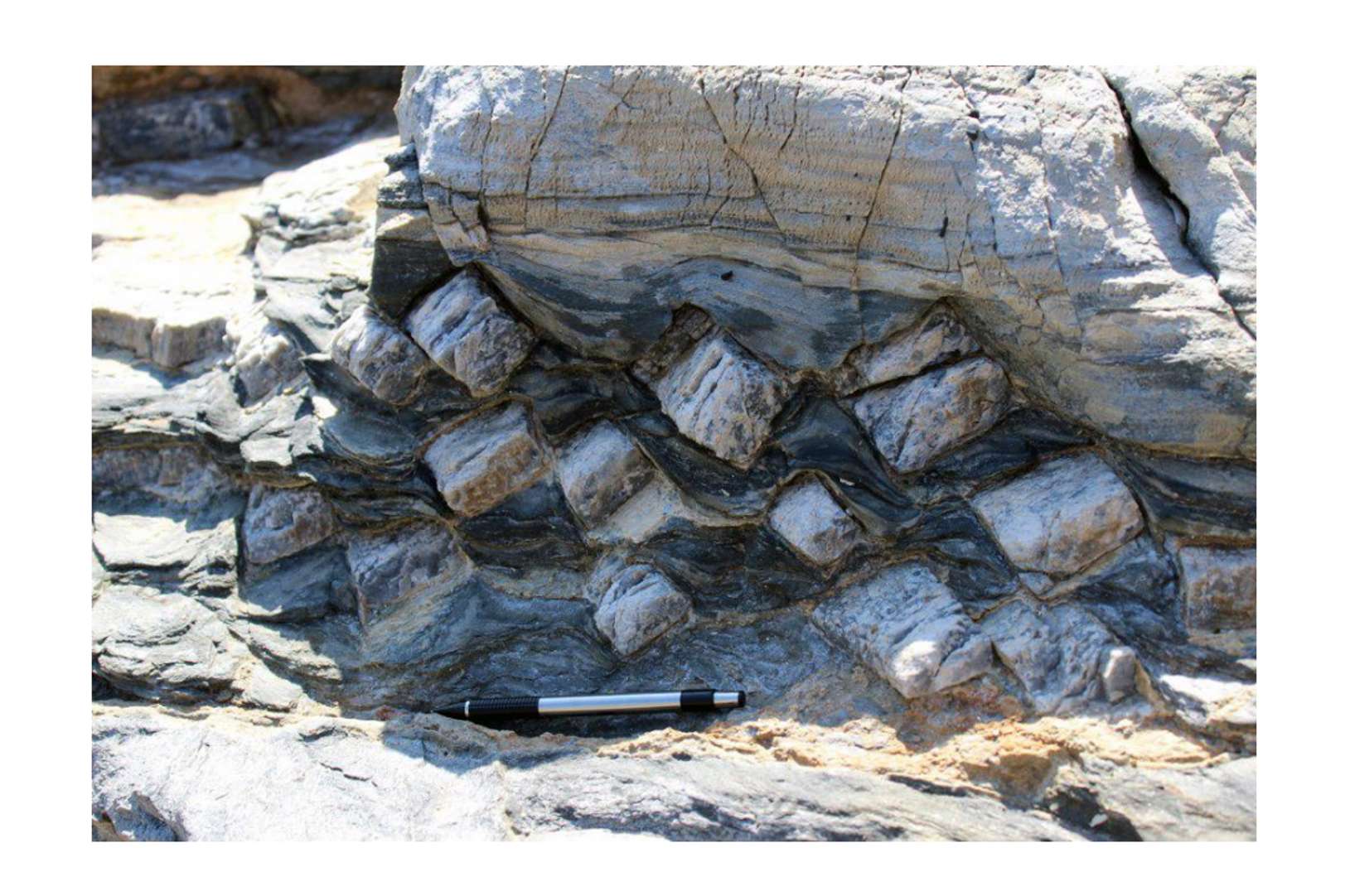 Solved Directions: Identify the fractures in the following | Chegg.com