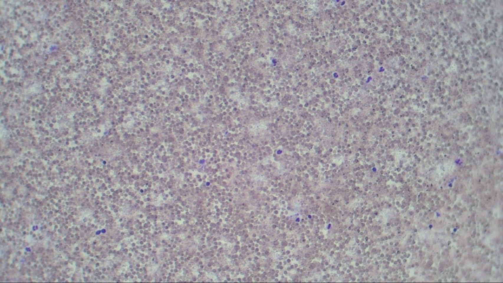 Is this photo a hypotonic, hypertonic, or isotonic | Chegg.com