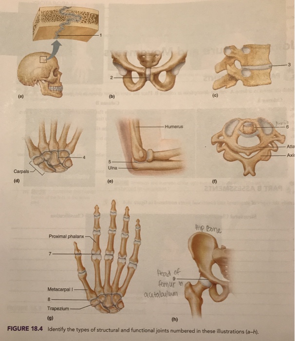 Solved Identify the types of structural and functional | Chegg.com Solved Identify the types of structural and functional | Chegg.com