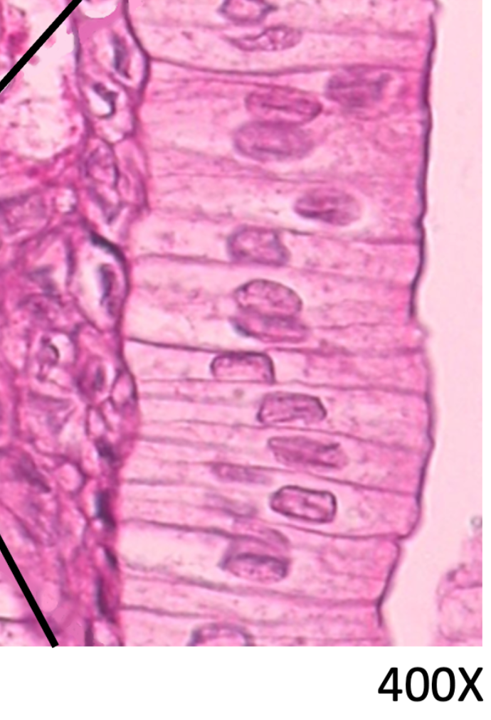 Solved This is an example of a simple squamous epithelium, | Chegg.com