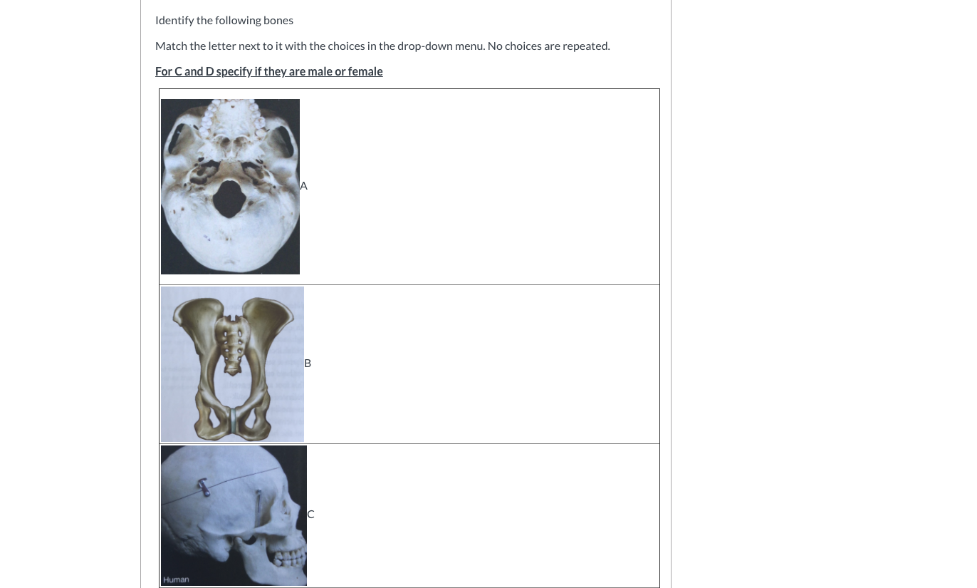Solved Identify the following bones and tools. Match the | Chegg.com