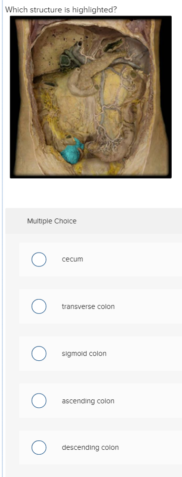 Solved Which structure is highlighted? Multiple Choice Ο | Chegg.com