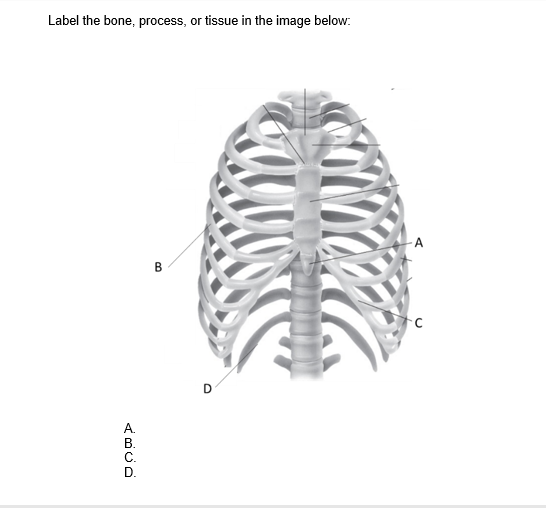 Solved Label the bone, process, or tissue in the image | Chegg.com