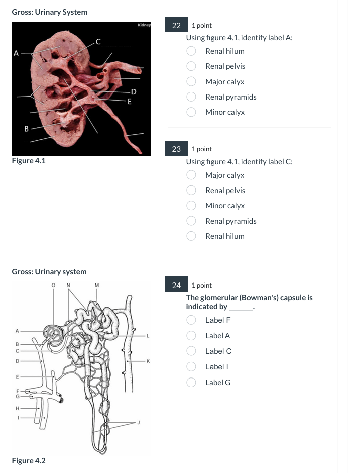 Solved 22 1 ﻿pointUsing figure 4.1, ﻿identify label A:Renal | Chegg.com