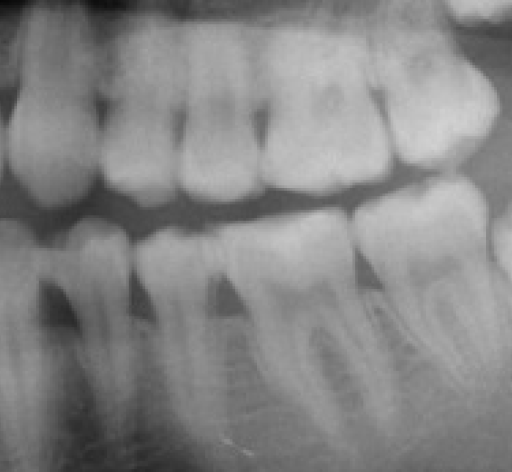 Solved PLEASE HELP!! USING MATLAB Use the dental radiograph | Chegg.com