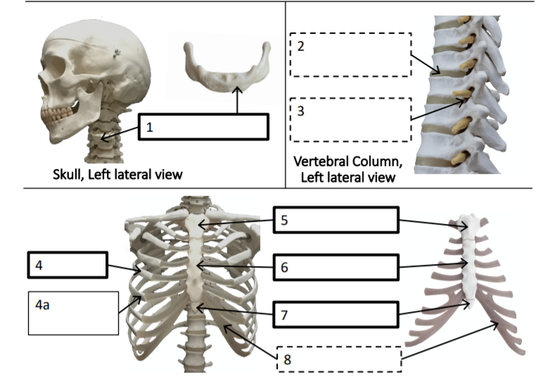 Solved 2 3 1 Skull, Left lateral view Vertebral Column, Left | Chegg.com