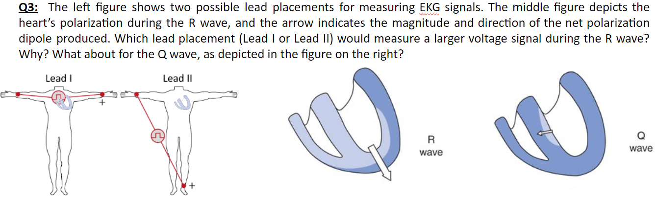 Solved Q3: The left figure shows two possible lead | Chegg.com