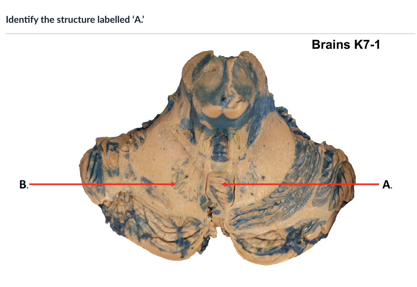 Solved Identify the structure labelled ' A.' | Chegg.com
