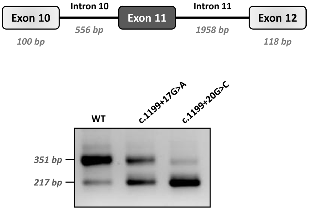 Solved Phenylketonuria (PKU) is caused by mutations in the | Chegg.com