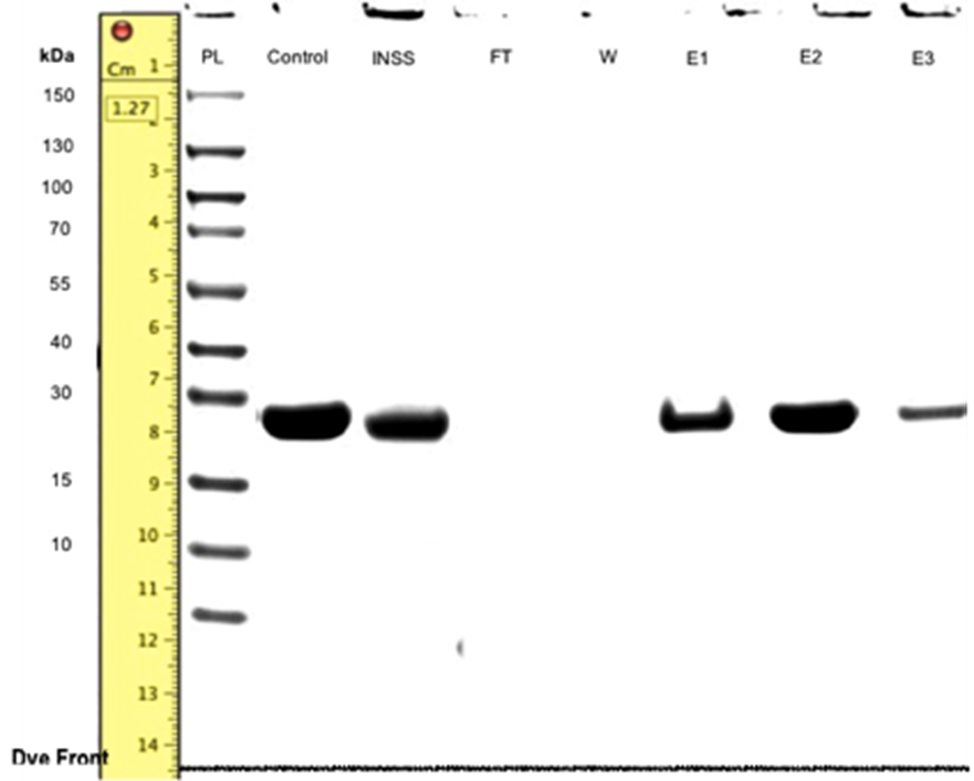Solved 3. Analyze the results of the Western Blot shown in | Chegg.com