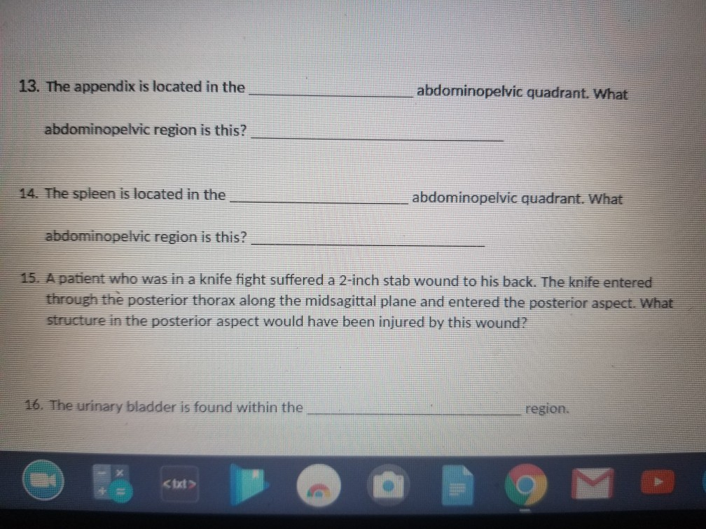 Solved 13. The appendix is located in the abdominopelvic | Chegg.com