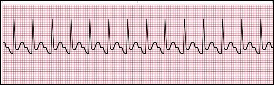Solved بم لحسم ملح سما Whhhhhhhhhhhhhhhh | Chegg.com