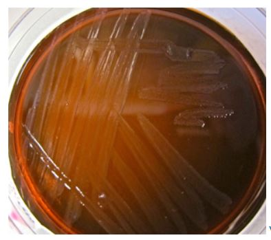 Solved A bacterial sample was grown on Eosin Methylene Blue | Chegg.com