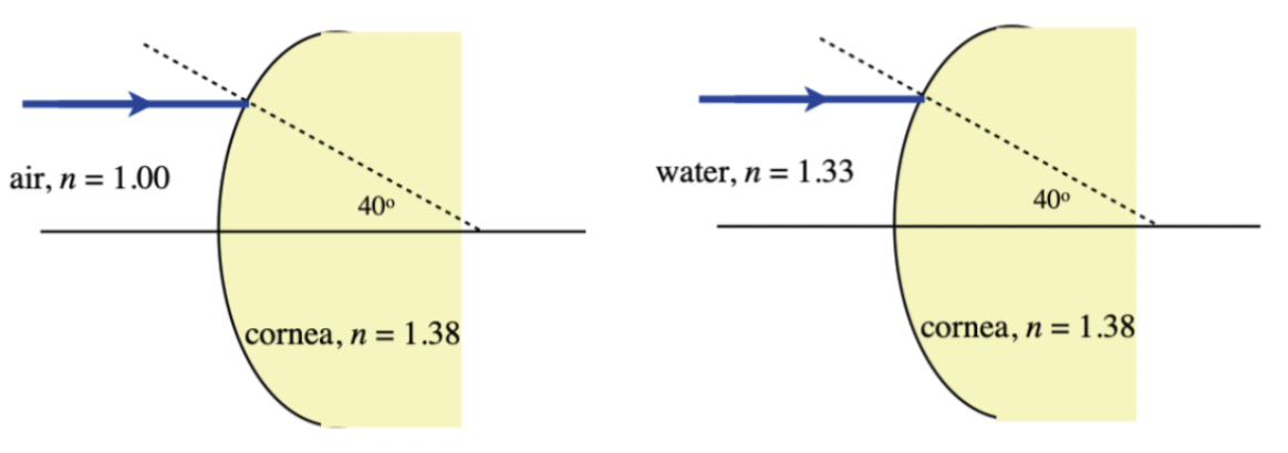 Solved In the two diagrams given, the cornea of an eye is | Chegg.com
