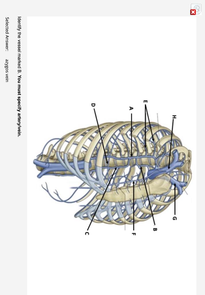 Solved Identify the vessel marked E. You must specify | Chegg.com