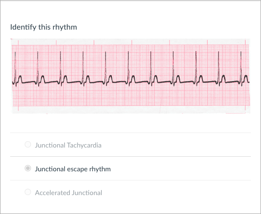Solved Identify this rhythm Junctional Tachycardia | Chegg.com
