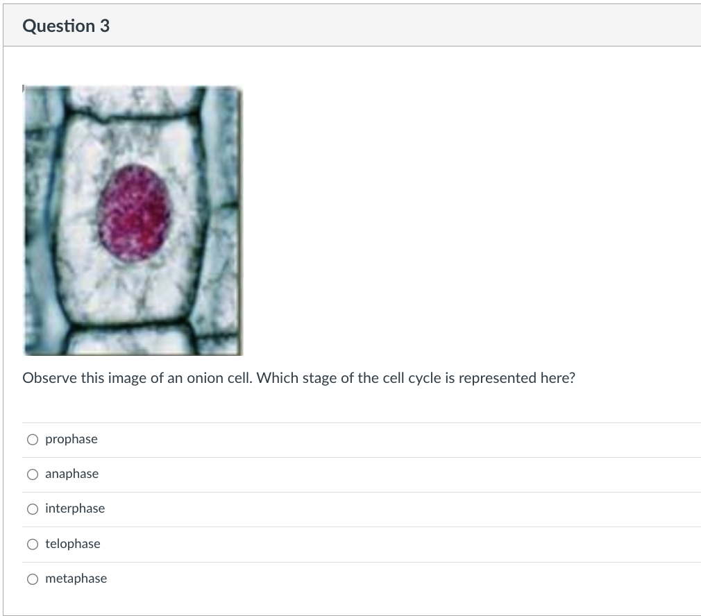 Solved Observe this image of an onion cell. Which stage of | Chegg.com