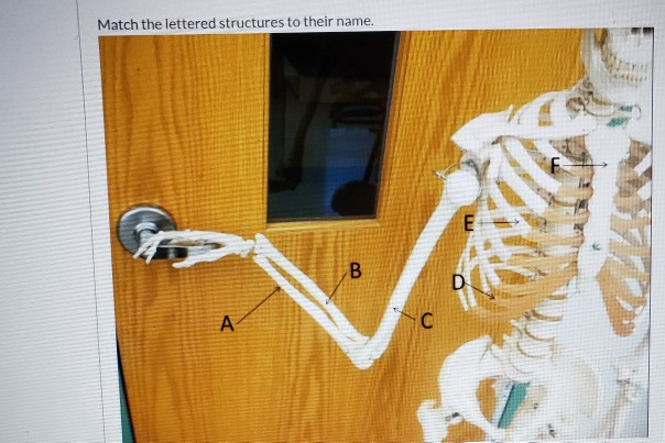 Solved Match the lettered structures to their name. Match | Chegg.com