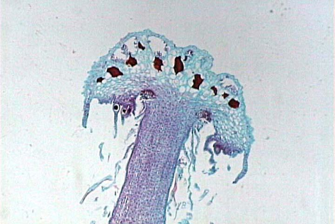 Solved Marchantia archegonial head - Please label an | Chegg.com