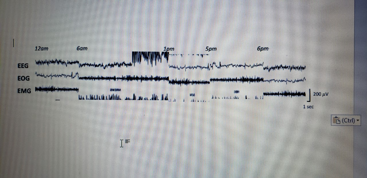 Solved This is the exact question that was given to me. | Chegg.com