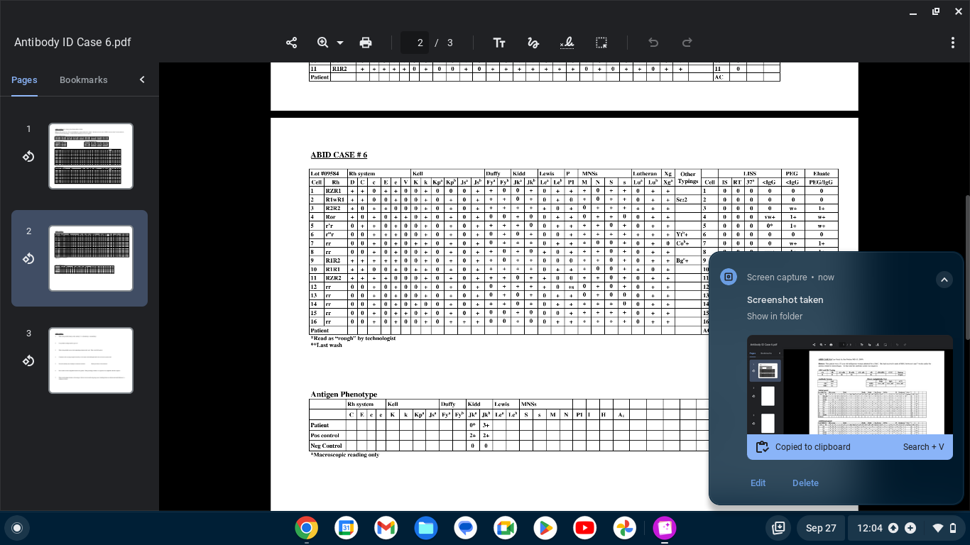 Solved ABID CASE \# 6 ABID CASE \#6 1. What is the | Chegg.com