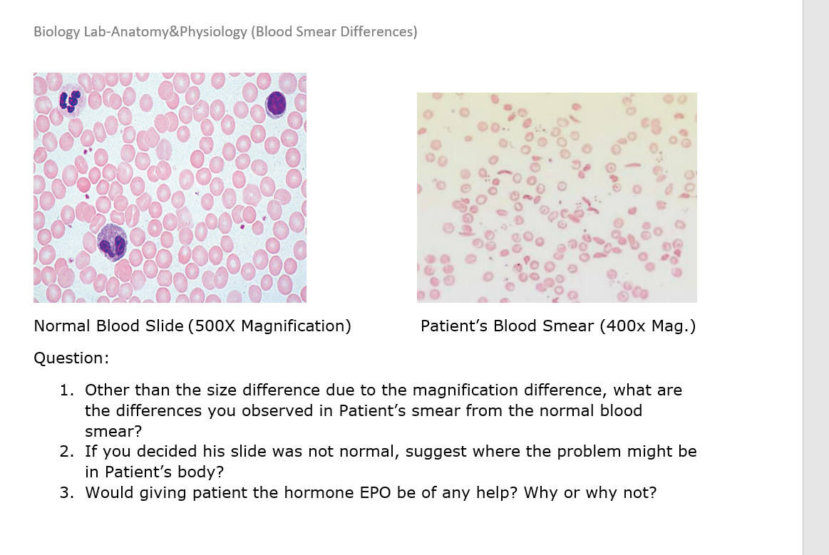 Solved Biology Lab-Anatomy&Physiology (Blood Smear | Chegg.com