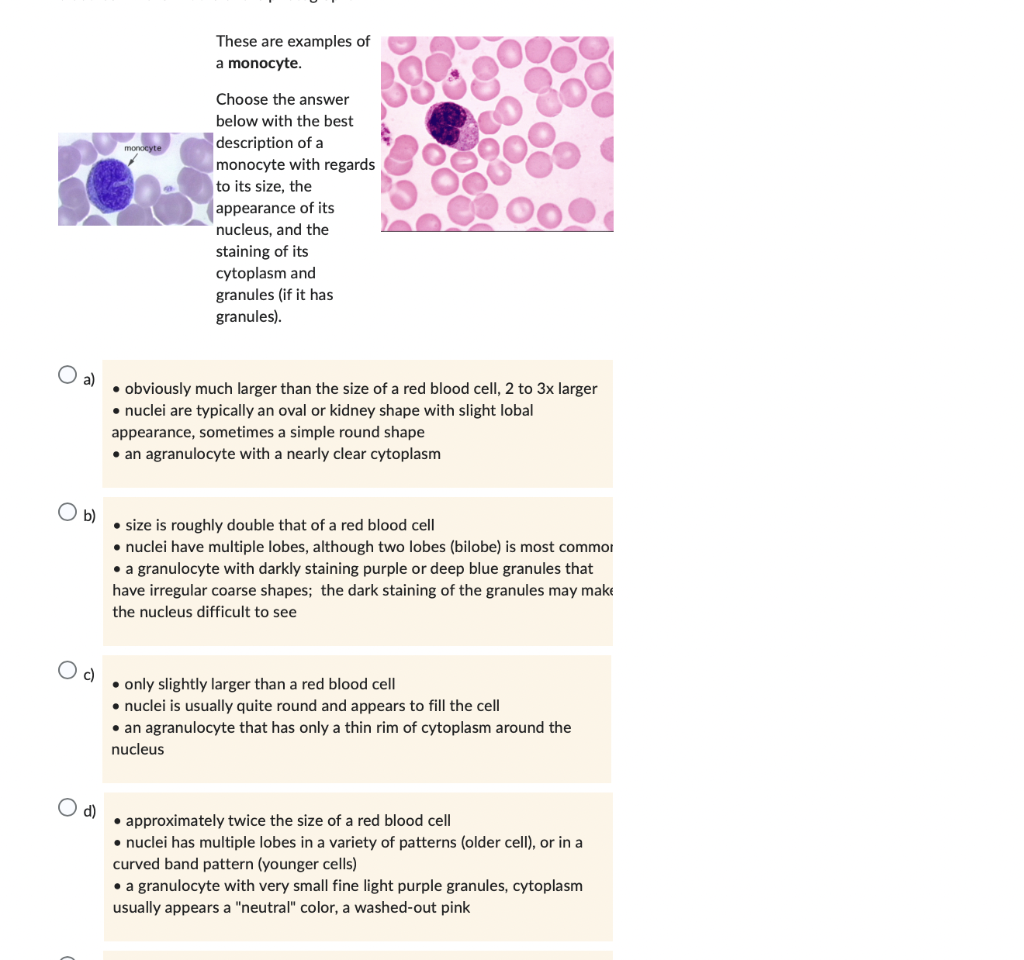 Solved These are examples of a lymphocyte. Choose the answer | Chegg.com