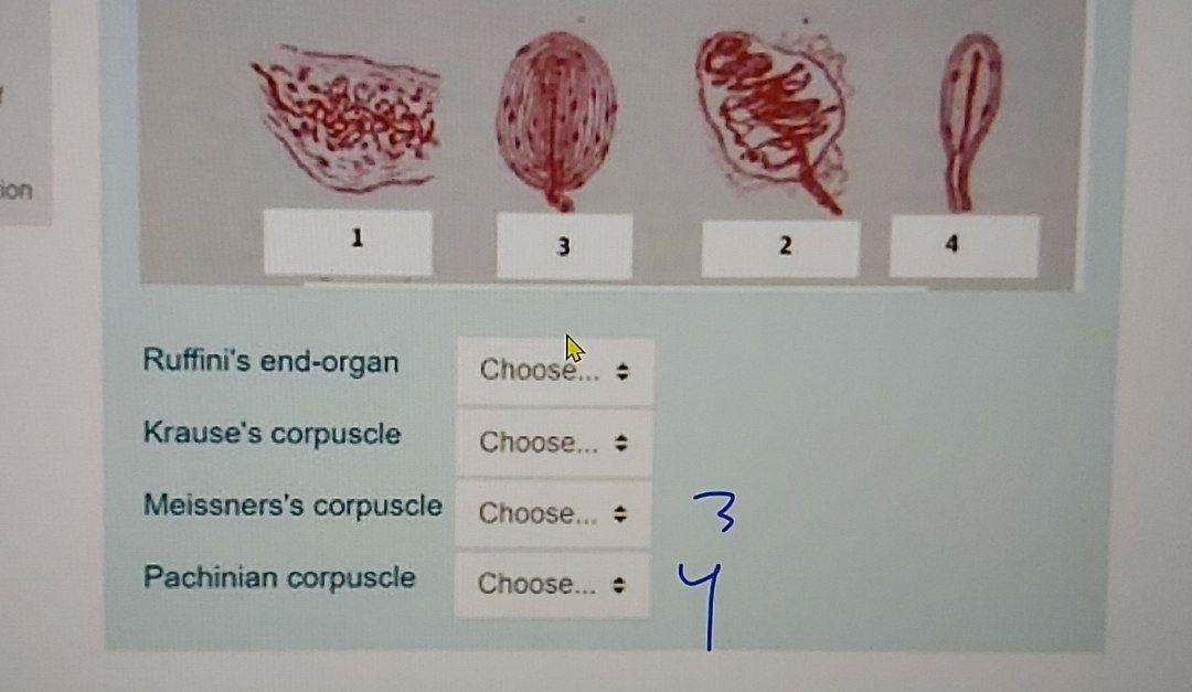 Solved hon 1 3 2 4 Ruffini's end-organ Choose..