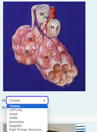 Solved Left Primary Bronchus Right Primary Bronchus | Chegg.com