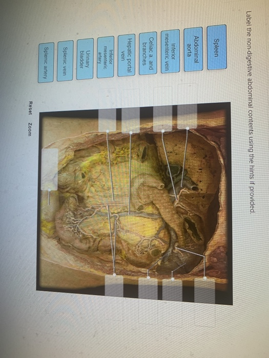 Solved w/connecthu Saved dominal contents using the hints if | Chegg.com