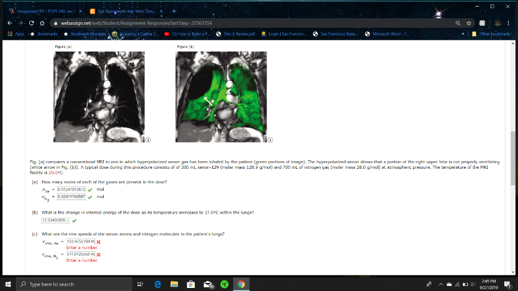 Solved Conventional magnetic resonance imaging (MRI) of the | Chegg.com