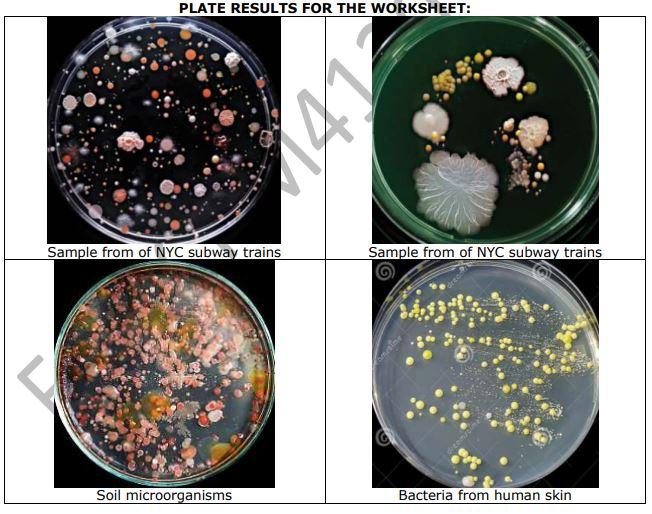 Table 1. Observations on the isolation plates. Source | Chegg.com