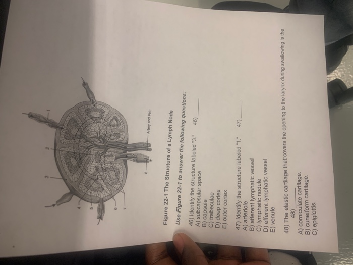Solved Figure 22-1 The Structure of a Lymph Node Use Figure | Chegg.com