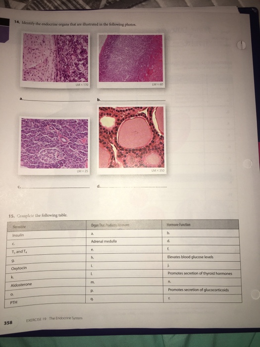 Solved 14. Identify the endocrine organs that are ilustrated | Chegg.com